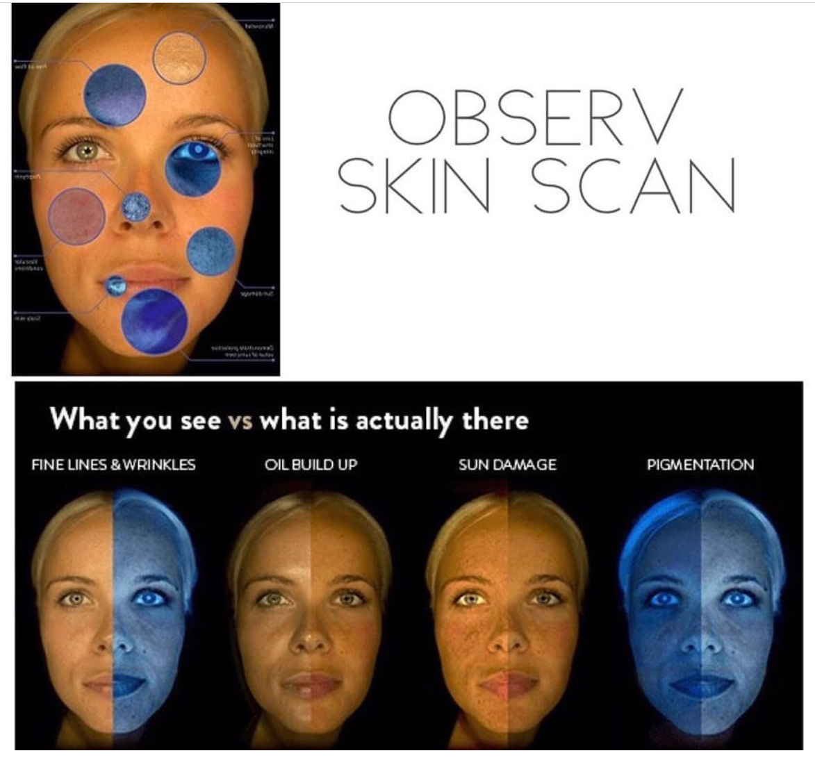 Skin Analysis Consultation - SkinMedico Clinic London